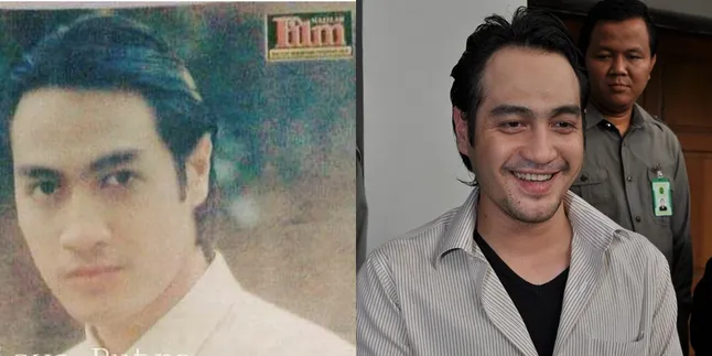 12 Photos of Ferry Irawan's Transformation Before Serious Illness, His ...