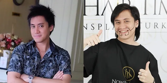 7 Moments Kevin Aprilio Hair Transplant, Lack of Confidence Because of ...