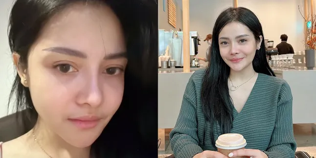 8 Latest Photos of Mawar AFI After Rhinoplasty Worth More than RP70 ...