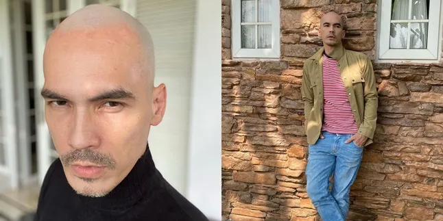 Astonishing! 9 Latest Photos of Atalarik Syach with a Bald Head - Used ...