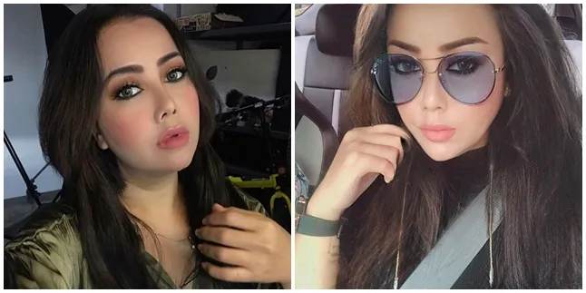 Swollen Chin, Here are 5 Beautiful Portraits of Rency Milano Before Experiencing Malpractice