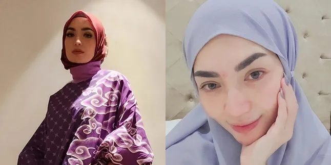 Recovered from Cancer, Latest Portrait of Imel Putri Cahyati Who is Now ...