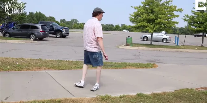 Kondisi Aneh Yang Dialami Pria Ini Membuatnya Bisa Memutar Kaki Sampai ...